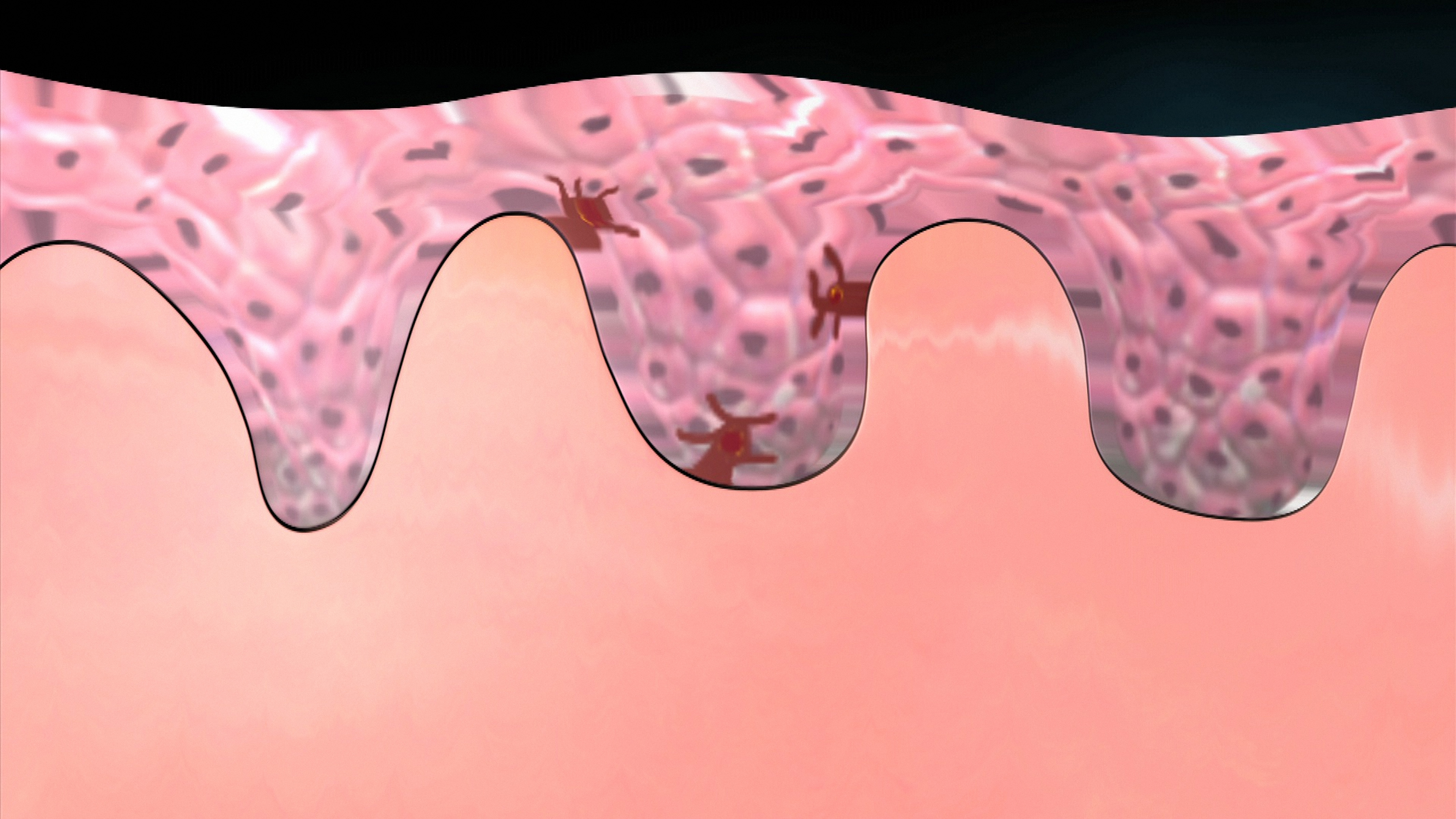 Newsela | What is melanin, and how does it affect our eye, skin and ...